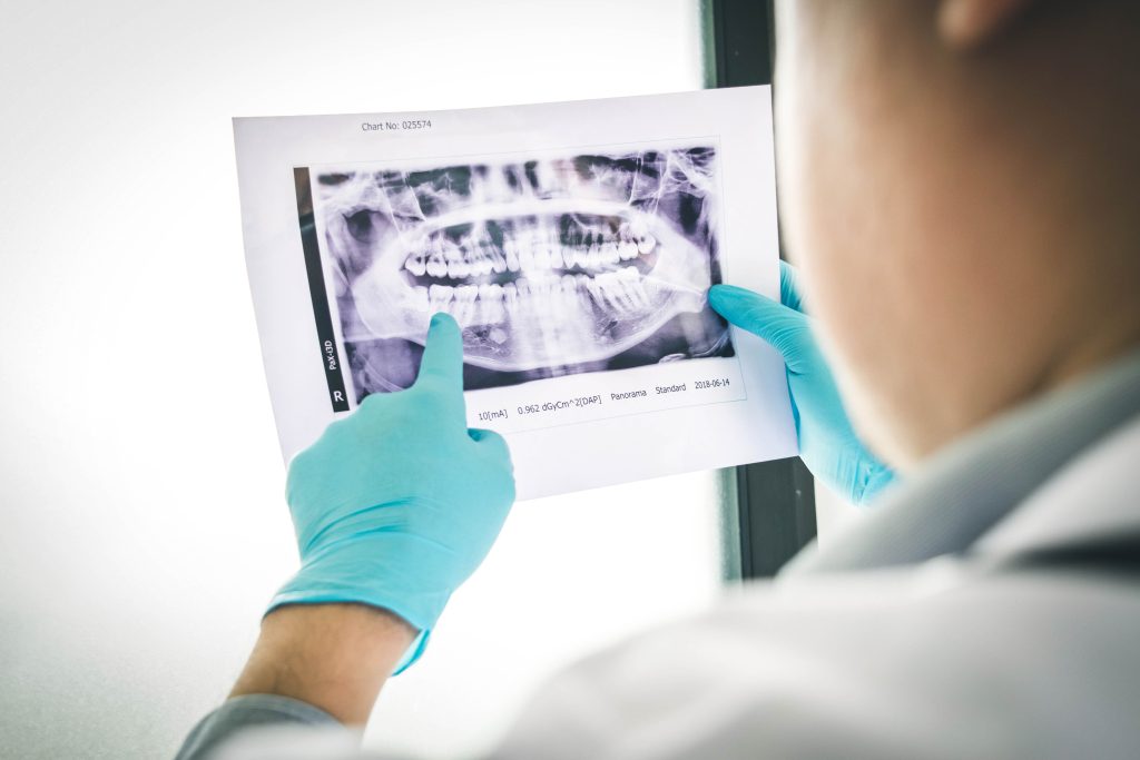 Wisdom Teeth Surgery Gold Coast | Pimpama Dental