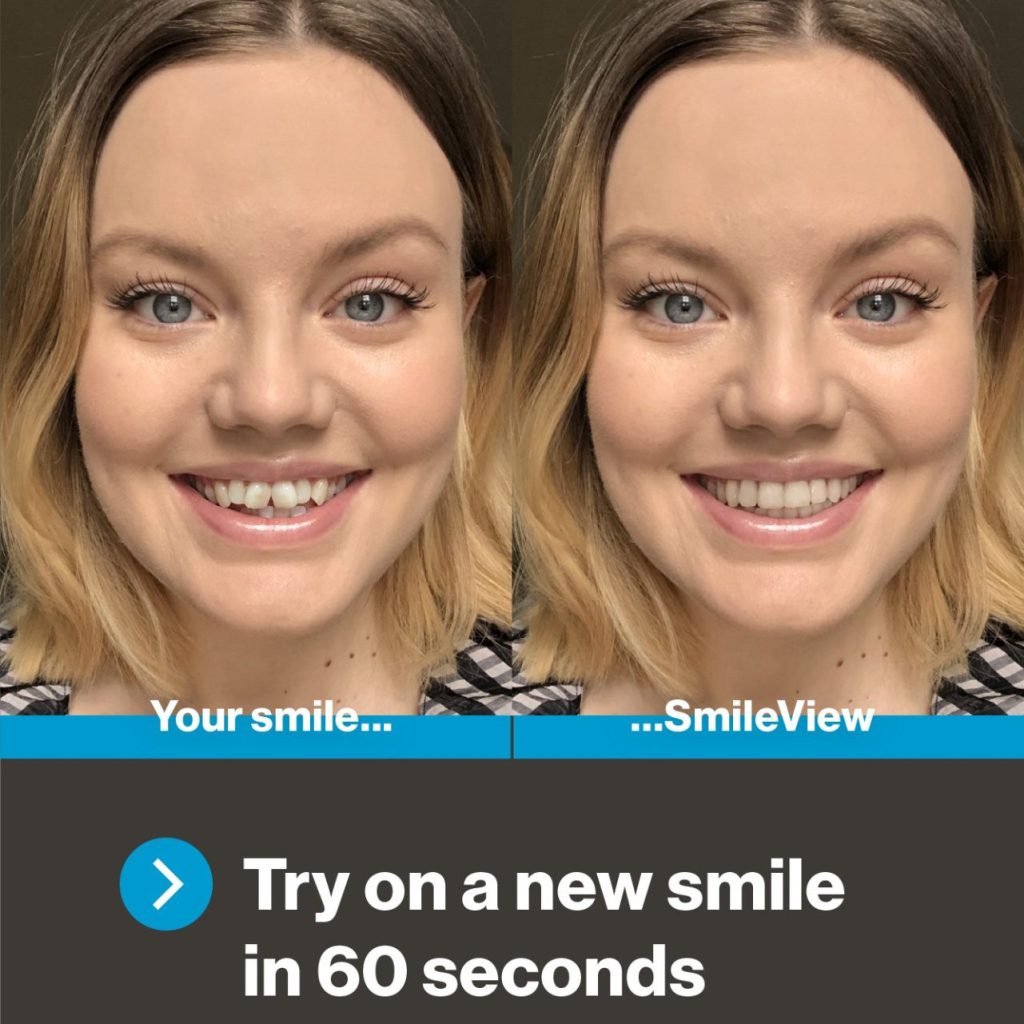 Invisalign | Pimpama Dental